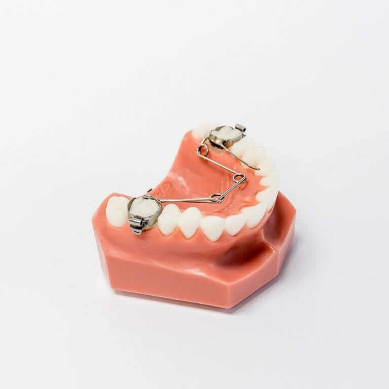 Dental Midline, Midline Discrepancy, and Misplaced Midline