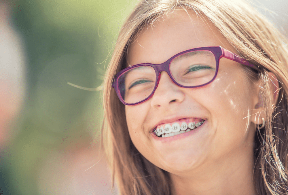 Fun Facts About Braces - Burke & Redford Orthodontists