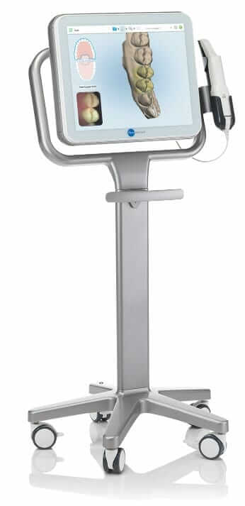 iTero® Intraoral Scanner - Digital Scanner for Your Invisalign® & Retainers
